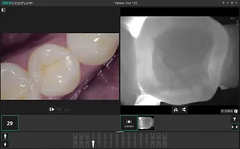 Advanced Technology we use at Blue Brush Dental