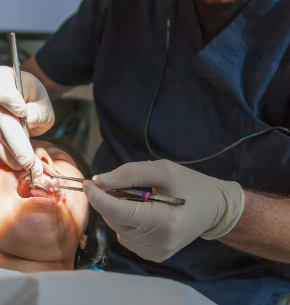 Oral Surgery | Top Oral Surgery in Irvine, CA